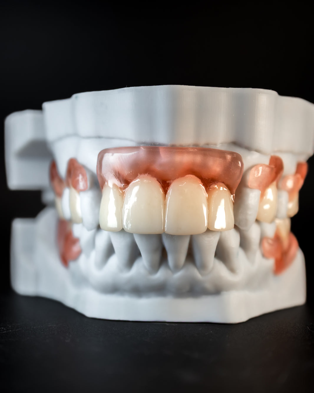 Root Dental Lab – RootLabUSA